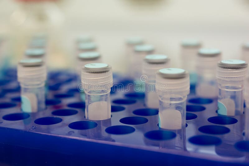 Test Tubes in a Blue Tray with Blue Labels Editorial Photo - Image of ...