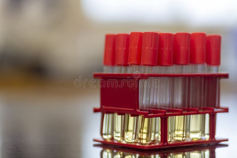 Biochemical Test for Bacteria Identification Stock Image - Image of ...