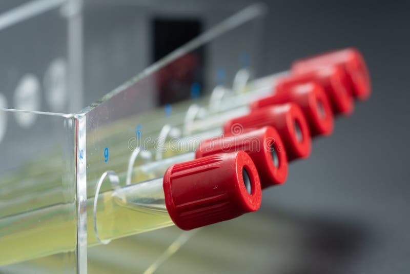 Test Tubes with Chemical Samples Stock Image - Image of test, science ...