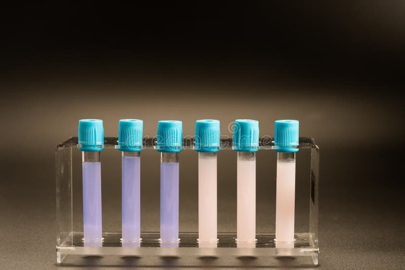 Test Tubes with Chemical Samples Stock Image - Image of pipette ...