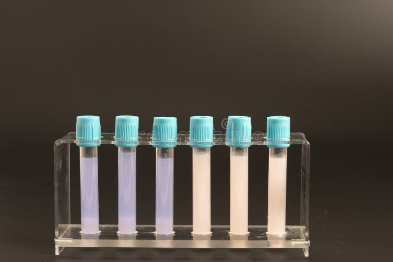 Test Tubes with Chemical Samples Stock Image - Image of liquid ...