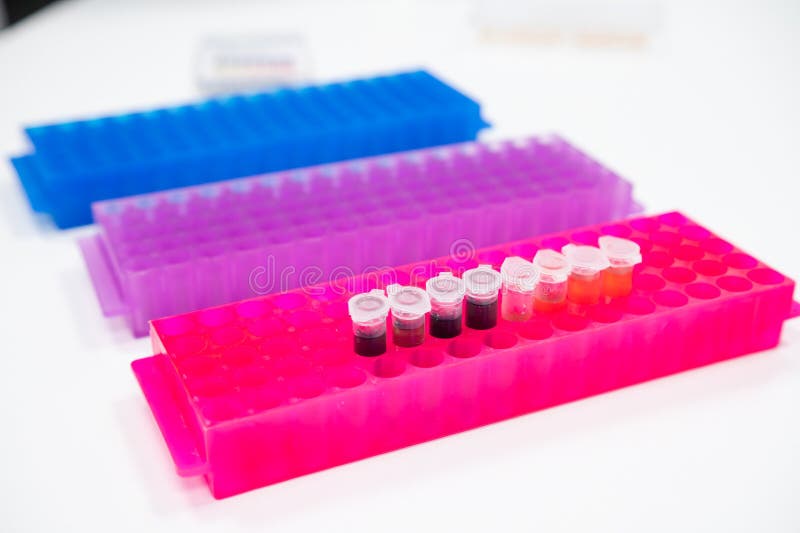 Test Tubes in Colorful Racks for Chemical Analysis Stock Image - Image ...