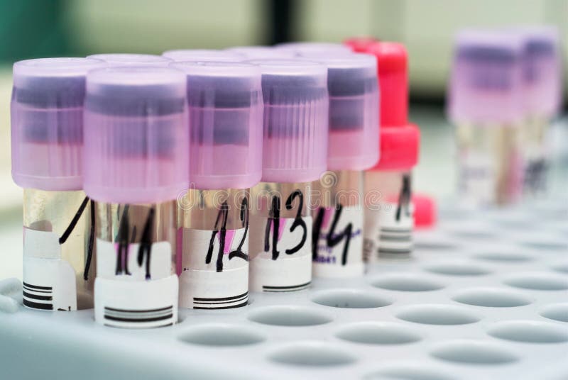 Test tubes in gray rack stock image. Image of medical - 12080941