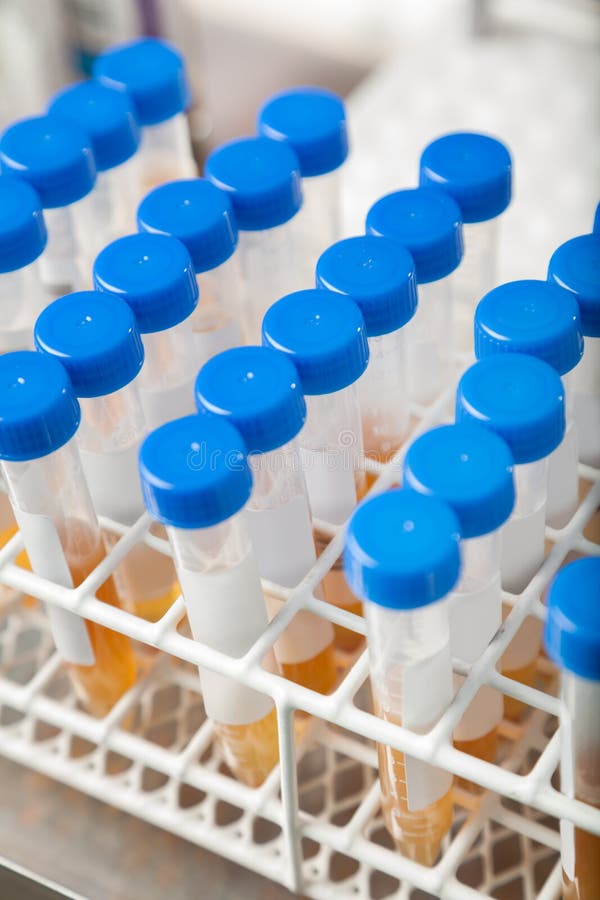 Laboratory Technician Holding a Blood Tube Test Stock Photo - Image of ...