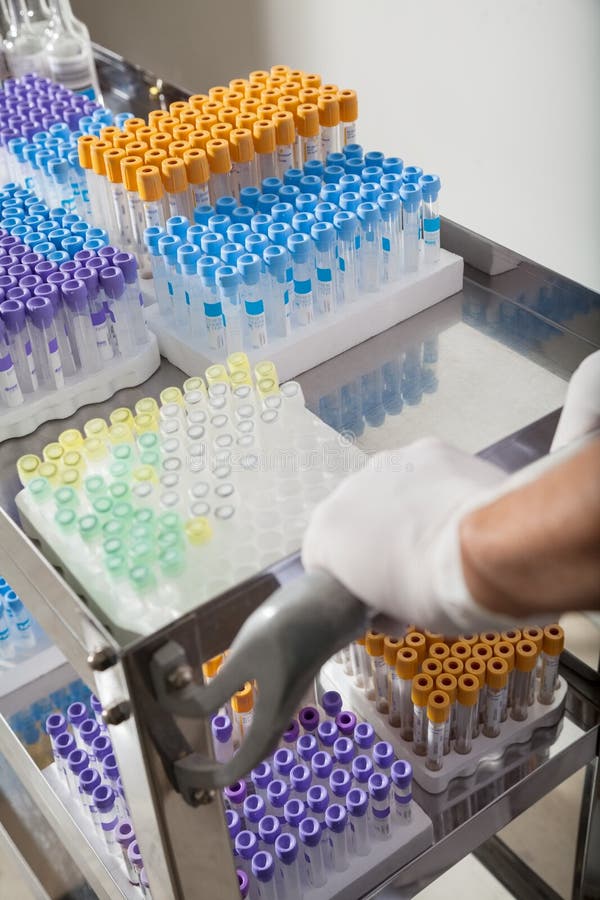 Test Tubes on Medical Trolley Stock Photo - Image of people ...