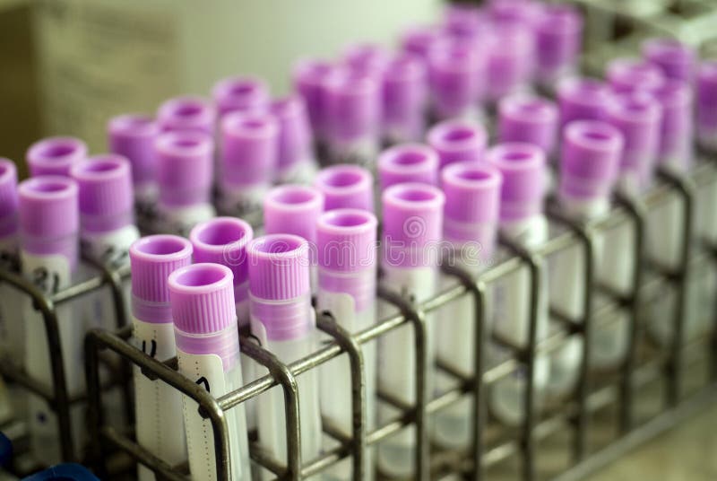 Test tubes in metal rack stock photo. Image of hospital - 15430028
