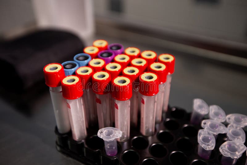 Test Tubes with Red Caps for Analysis. Laboratory of Analysis and ...