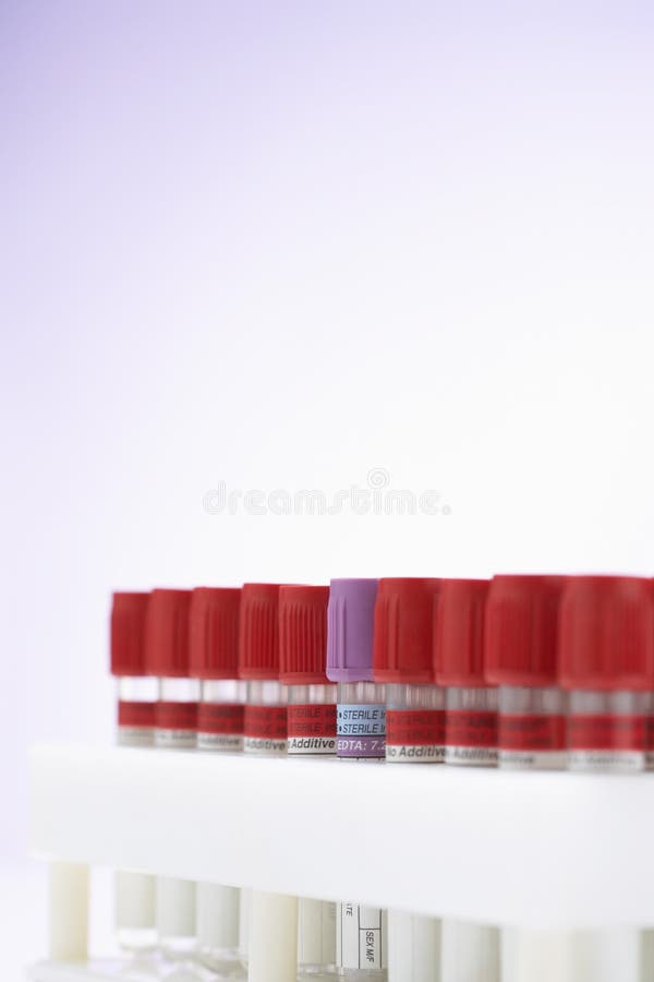 Test Tubes with Red Lids Surrounding One with Purple Lid Stock Photo ...