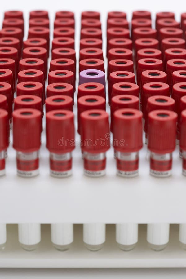 Test Tubes with Red Lids Surrounding One with Purple Lid Stock Photo ...