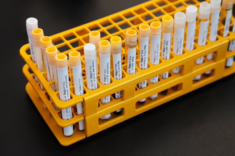 Test Tubes with Samples in Yellow Rack Stock Image - Image of rack ...