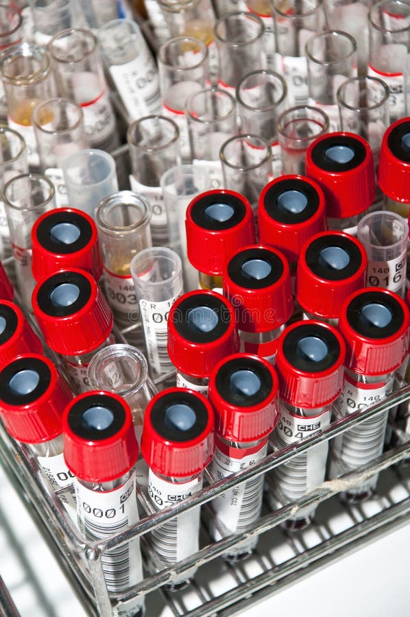 Rack of Blood Tubes Labeled in Blood Bank Lab Stock Photo - Image of ...