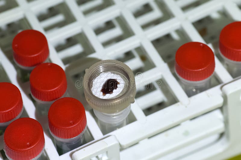 Test Tubes with Stand. Open Tube Stock Photo - Image of beaker ...