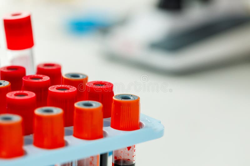 Test Tubes Tops in a Tray Close Up Stock Image - Image of group ...