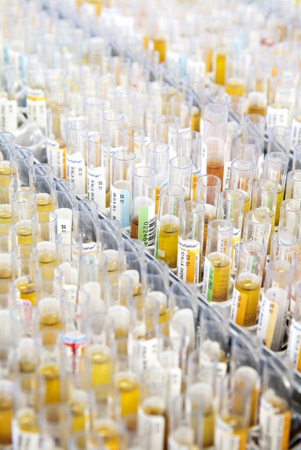 Test Tubes for Urine Analysis in Laboratory Stock Image - Image of ...