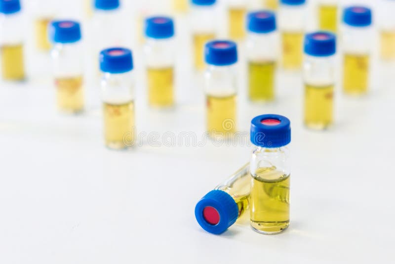 Test Tubes with Urine Sample for HPLC Analysis in the Laboratory Stock ...