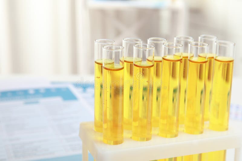 Test Tubes with Samples in Rack on Table, Space for Text. Solution ...