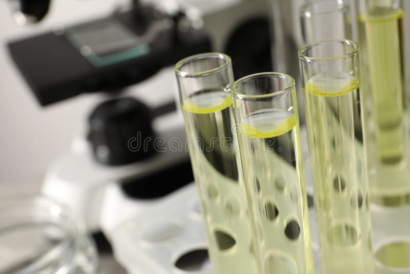 Test Tubes with Urine Samples for Analysis in Holder Near Microscope ...