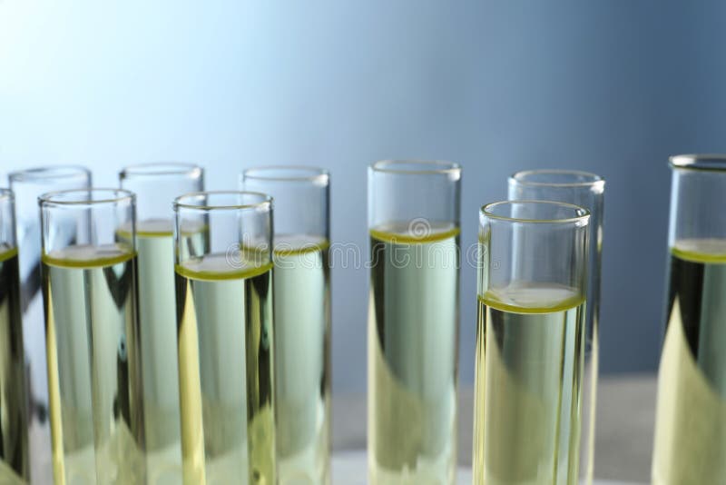Test Tubes with Urine Samples for Analysis in Laboratory, Closeup Stock ...
