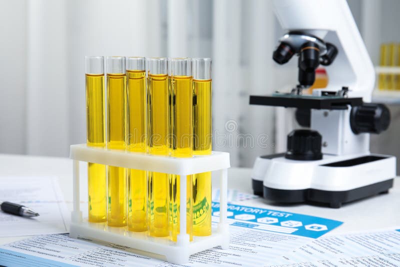 Test Tubes with Urine Samples for Analysis on Table in Laboratory Stock ...