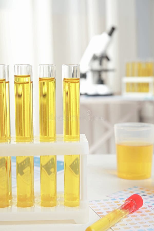 Urine Samples In Laboratory Glassware On Table Urology Concept Stock Image Image Of Dish