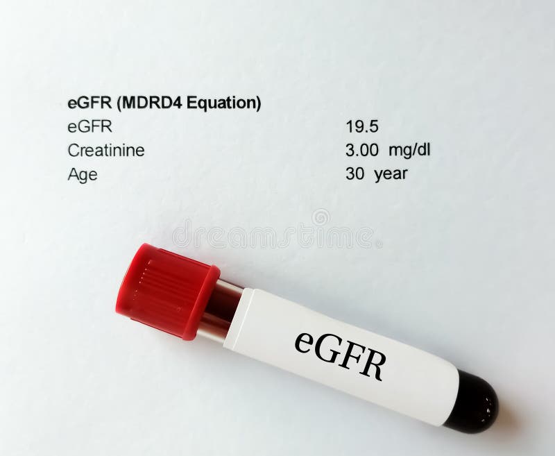 Teste Egfr Com Relatório Anormal Foto de Stock - Imagem de crônico ...