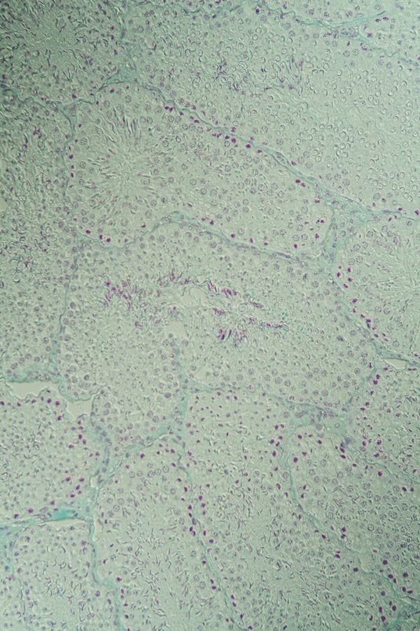 Testicle Cross-section Under the Microscope Stock Image - Image of 100x ...