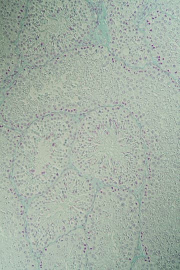 Mammalian Testes Transverse Section Stock Photos - Free & Royalty-Free ...