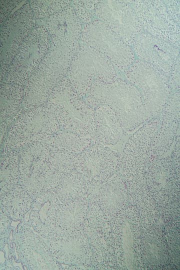 114 Testes Transverse Section Stock Photos - Free & Royalty-Free Stock ...