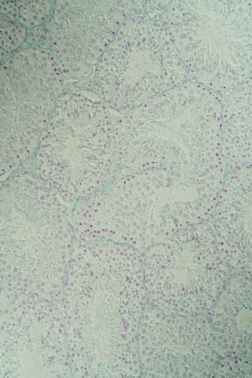 Mammalian Testes Transverse Section Stock Photos - Free & Royalty-Free ...