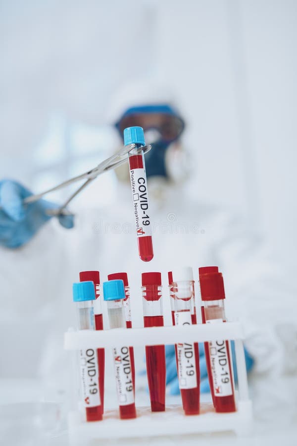 Testing blood samples stock photo. Image of analysis - 178714098