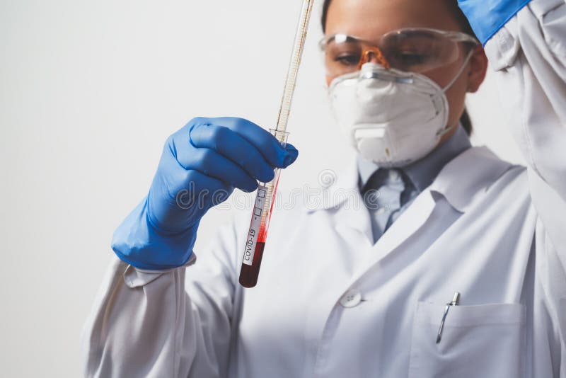 Testing Blood Samples for the Virus Stock Photo - Image of outbreak ...