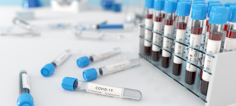 Testing for Coronavirus Covid-19 in a Lab. Covid Medical Screening ...