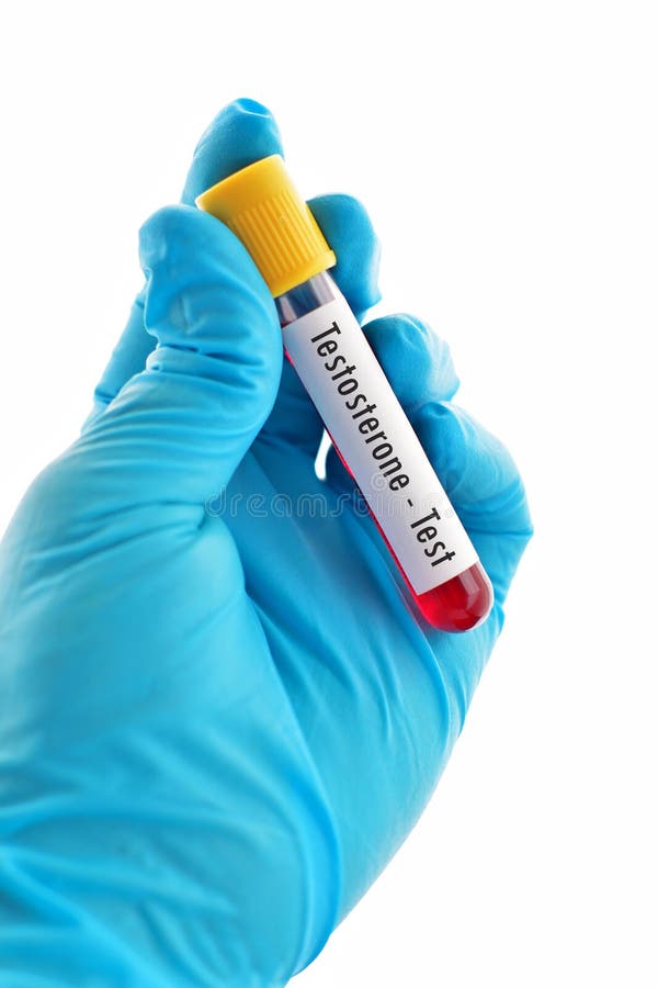 Testosterone test stock photo. Image of research, male - 70336324