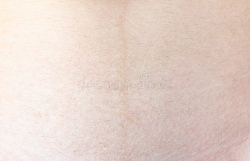 Textura de la piel humana foto de archivo. Imagen de cierre - 92664940