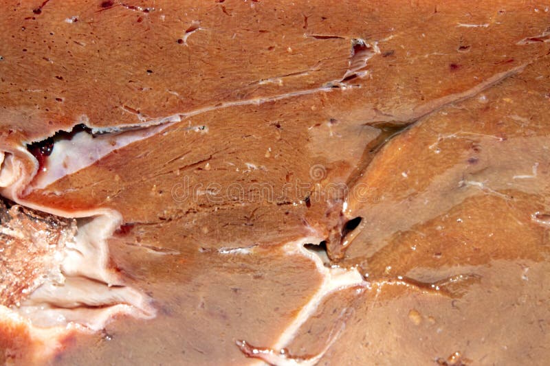 The Texture of Beef Liver.Fresh Raw Beef Liver Top View Stock Photo ...
