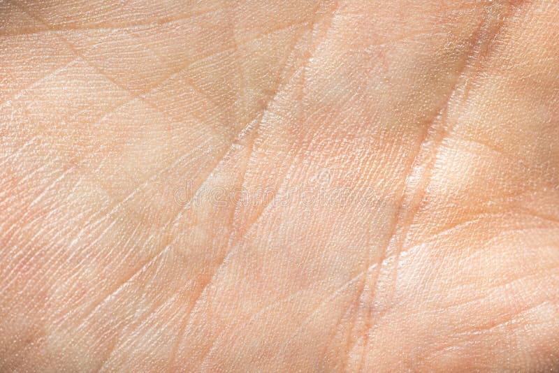 The Texture of the Skin of the Hand. Stock Image - Image of hide, rough ...