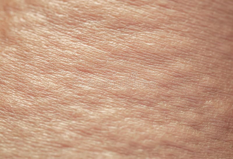 Texture Of Irritated Reddened Skin With Flaking Scales Of Dead Old