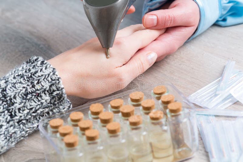 Therapist Finding an Acupuncture Point Stock Photo - Image of medicine ...