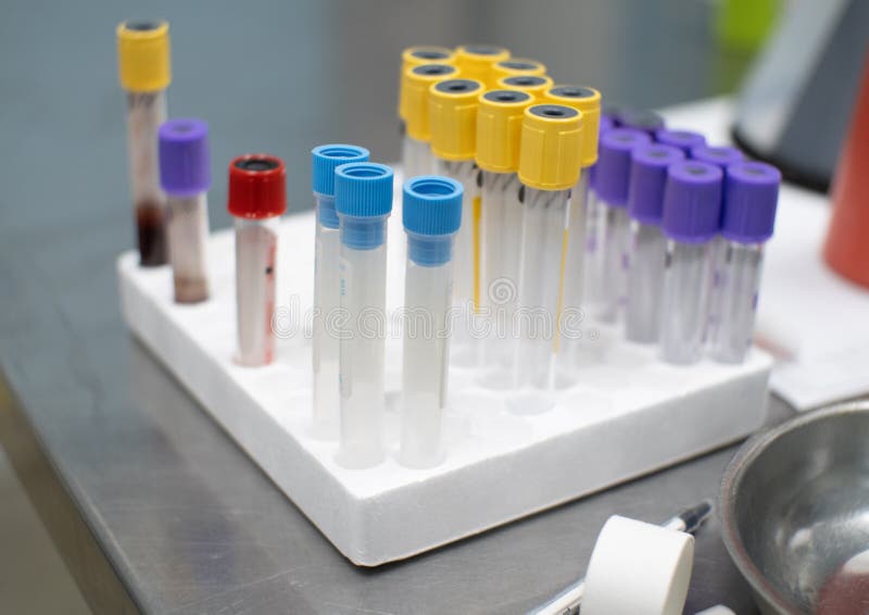 There are Test Tubes for Blood Samples on a Stand in the Laboratory ...