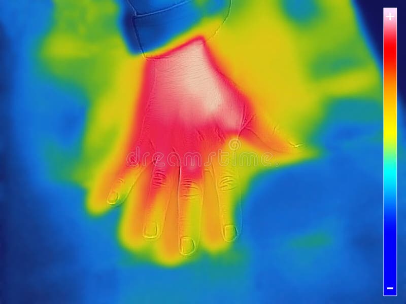 Thermal Image of Human Hand and Finger Using Thermal Camera Stock ...