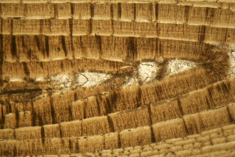 Thin Section of Nummulite Limestone Under the Microscope Stock Image ...