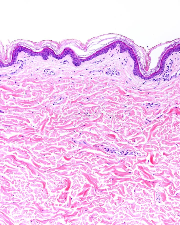 Thin skin stock photo. Image of cytological, hematoxylineosin - 230929148