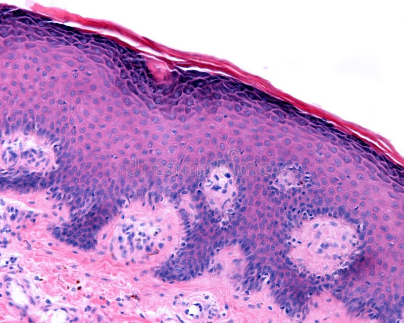 Thin Skin. Hematoxylin-eosin Stock Photo - Image of tissue, microscopy ...