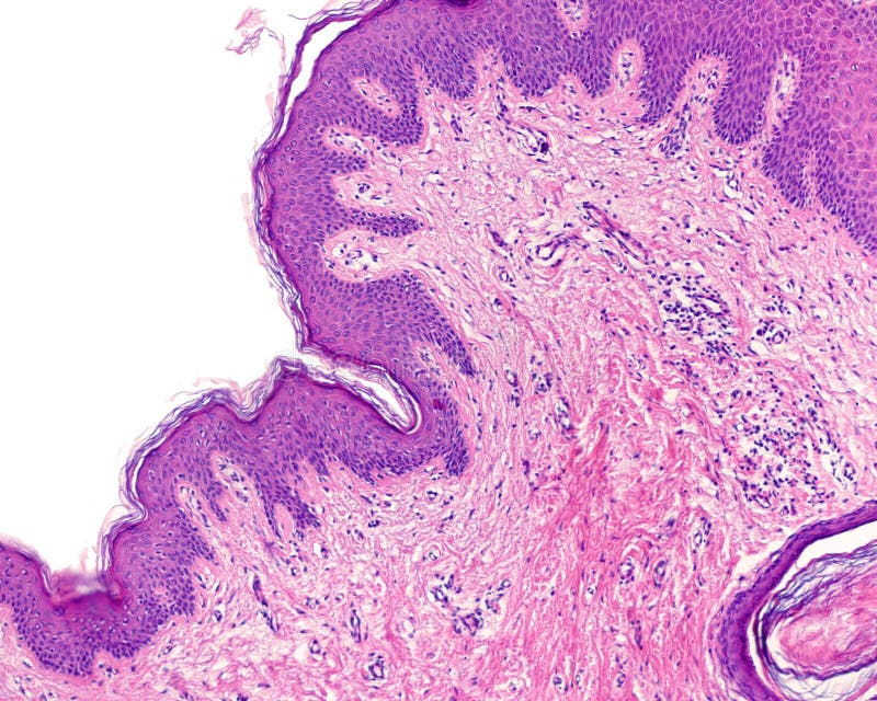 Thin skin stock photo. Image of epidermis, cell, cytological - 230929654