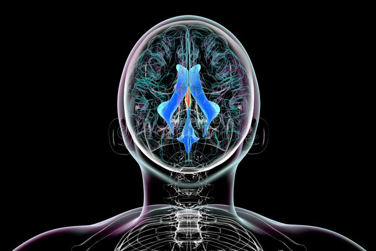 The Third Brain Ventricle, 3D Illustration Stock Illustration ...