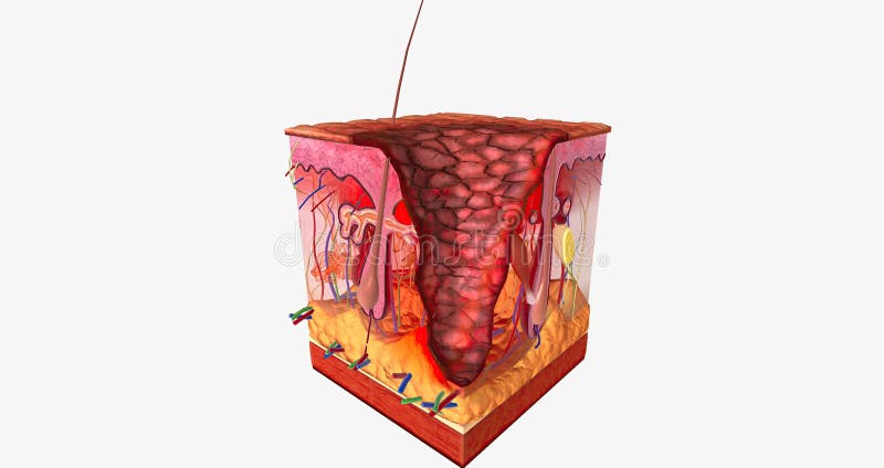 A Third Degree Burn Will Damage All of the Layers of the Skin: the ...