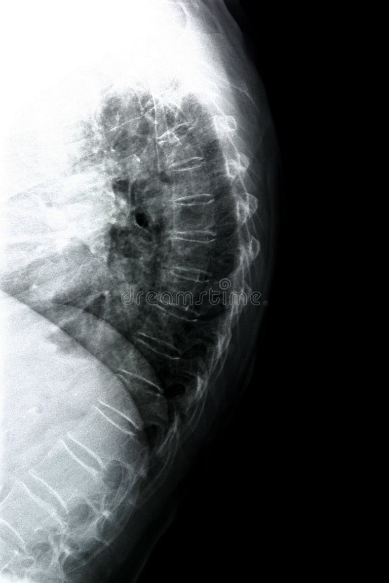 2,853 Thoracic Ganglia Stock Photos - Free & Royalty-Free Stock Photos ...