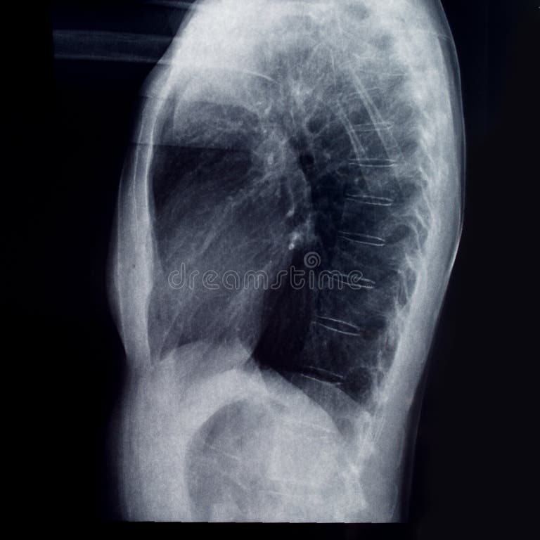 1,359 Human Thorax Anatomy Stock Photos - Free & Royalty-Free Stock ...