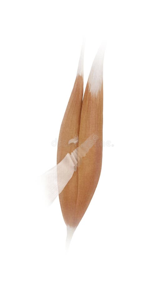 This is a Thorough Anatomical Representation of Arm Muscles with a ... This is a Thorough Anatomical Representation of Arm Muscles with a ...