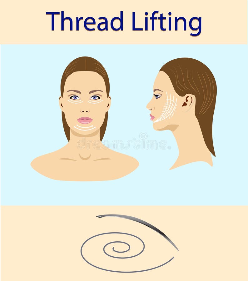 Thread Lifting, Vector Illustration, Face of a Girl Stock Vector ...